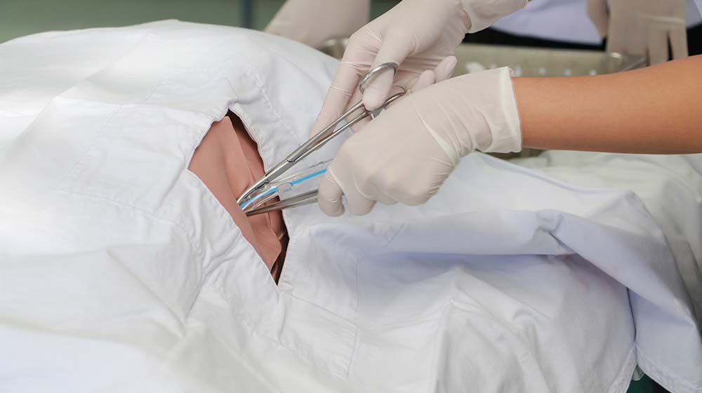 Thoracoscopic surgery - קרדיוהיל